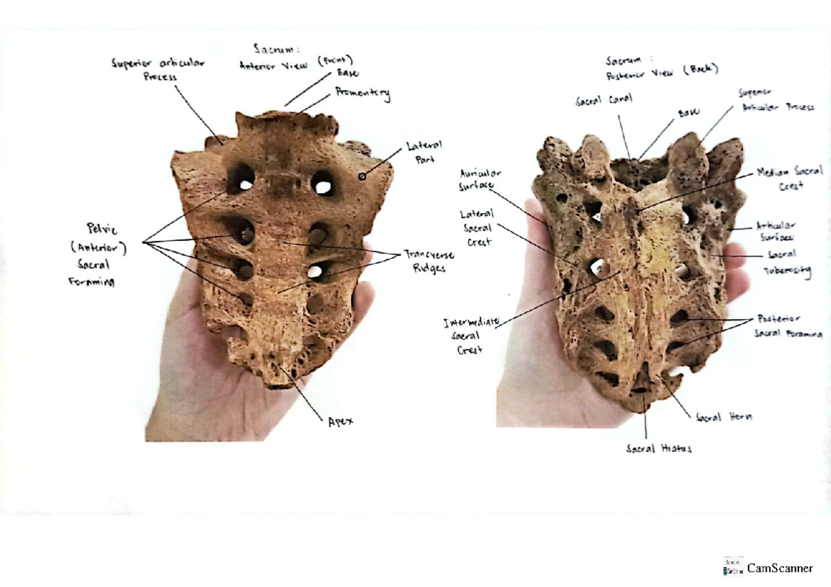 Sacrum - Scanned with Saval tuberosity promontory Pelvic (Anterior ...