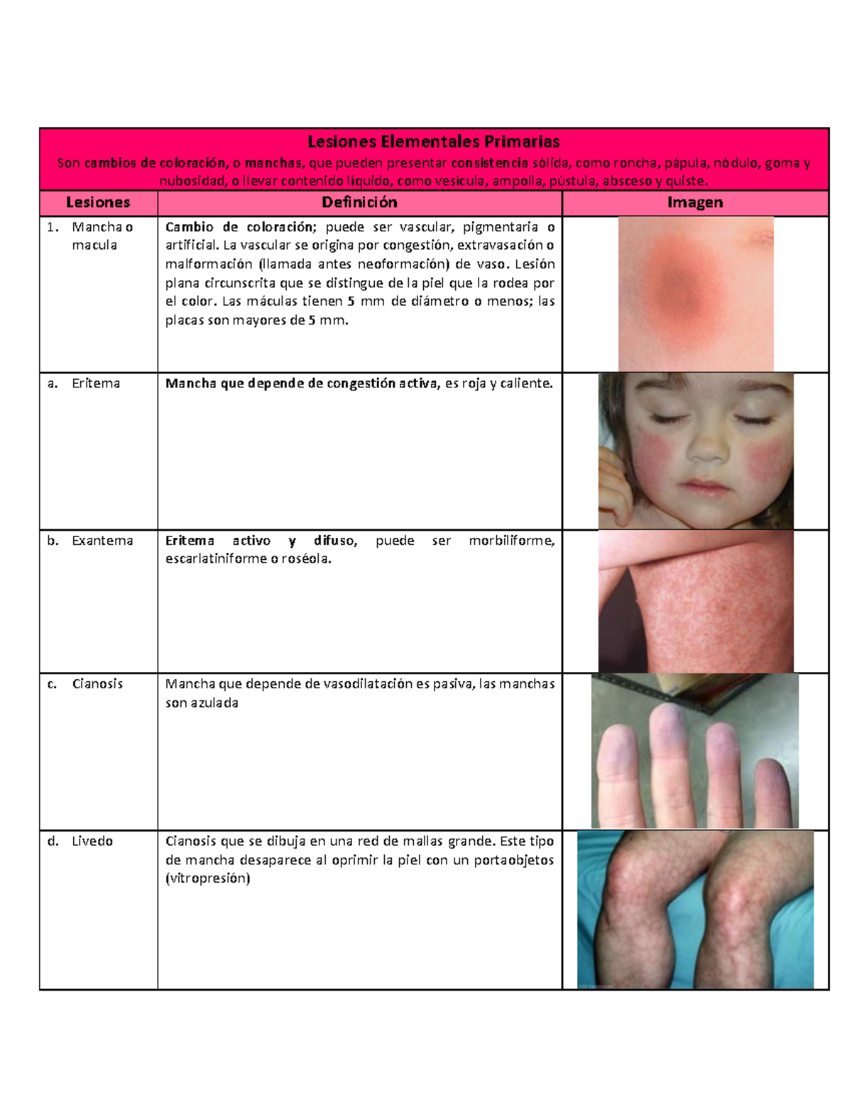 Lesiones Elementales - Lesiones Definición Imagen Mancha o macula ...