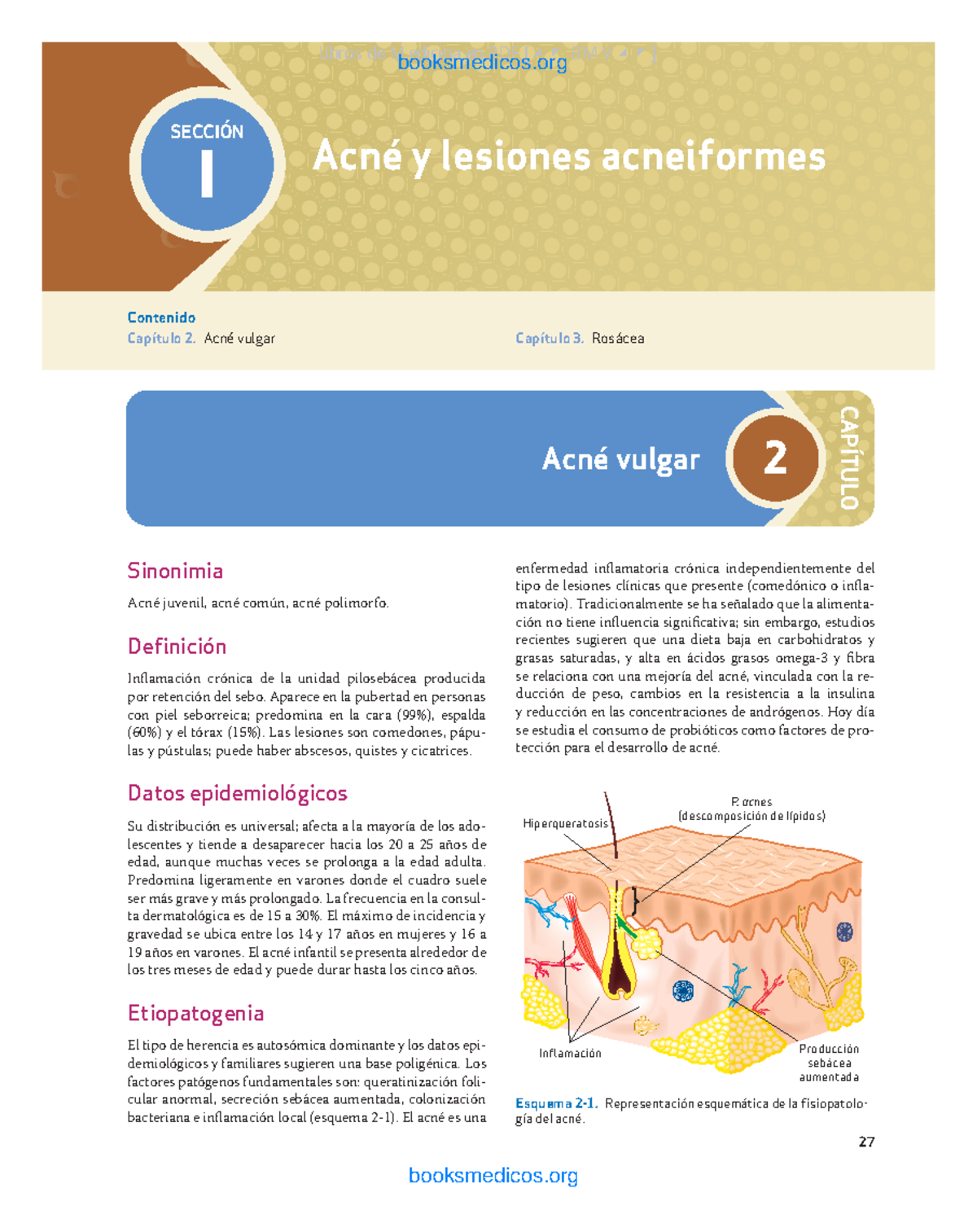 6.4 .-ACNE Vulgar - Resumen - Sinonimia Acné juvenil, acné común, acné ...