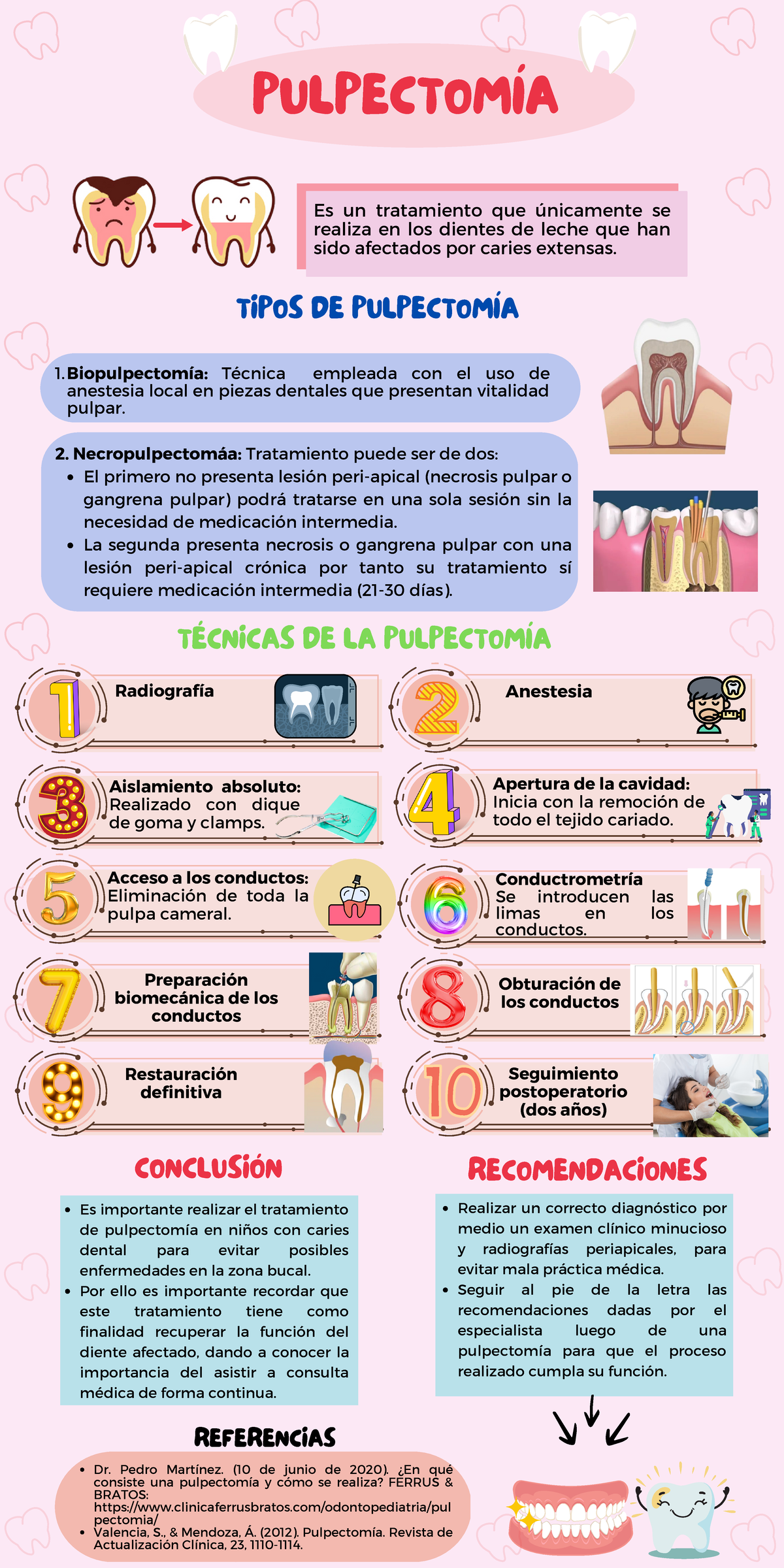 Infografia DE Odontopeditria Trabajo DE DRA Erika Suasnabas - TÉCNICAS DE LA PULPECTOMÍA ...