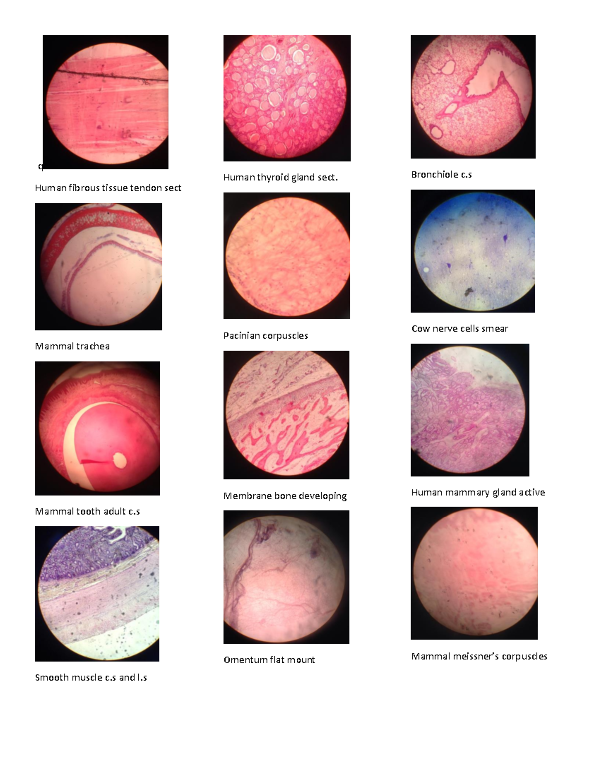 Pathology General Lab Compilation of Actual Tissue Slides 2024 - q ...