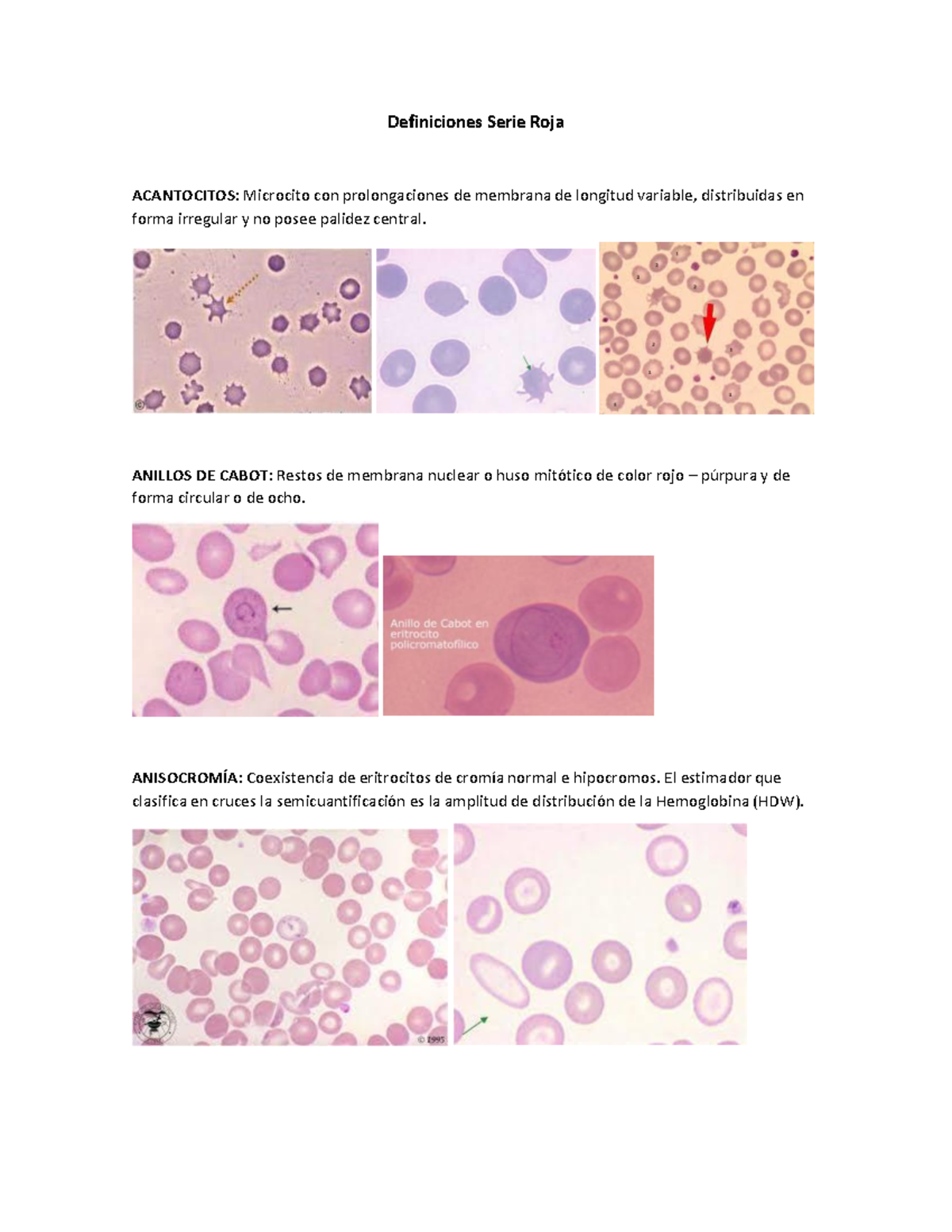 Definiciones Serie Roja - Definiciones Serie Roja ACANTOCITOS ...