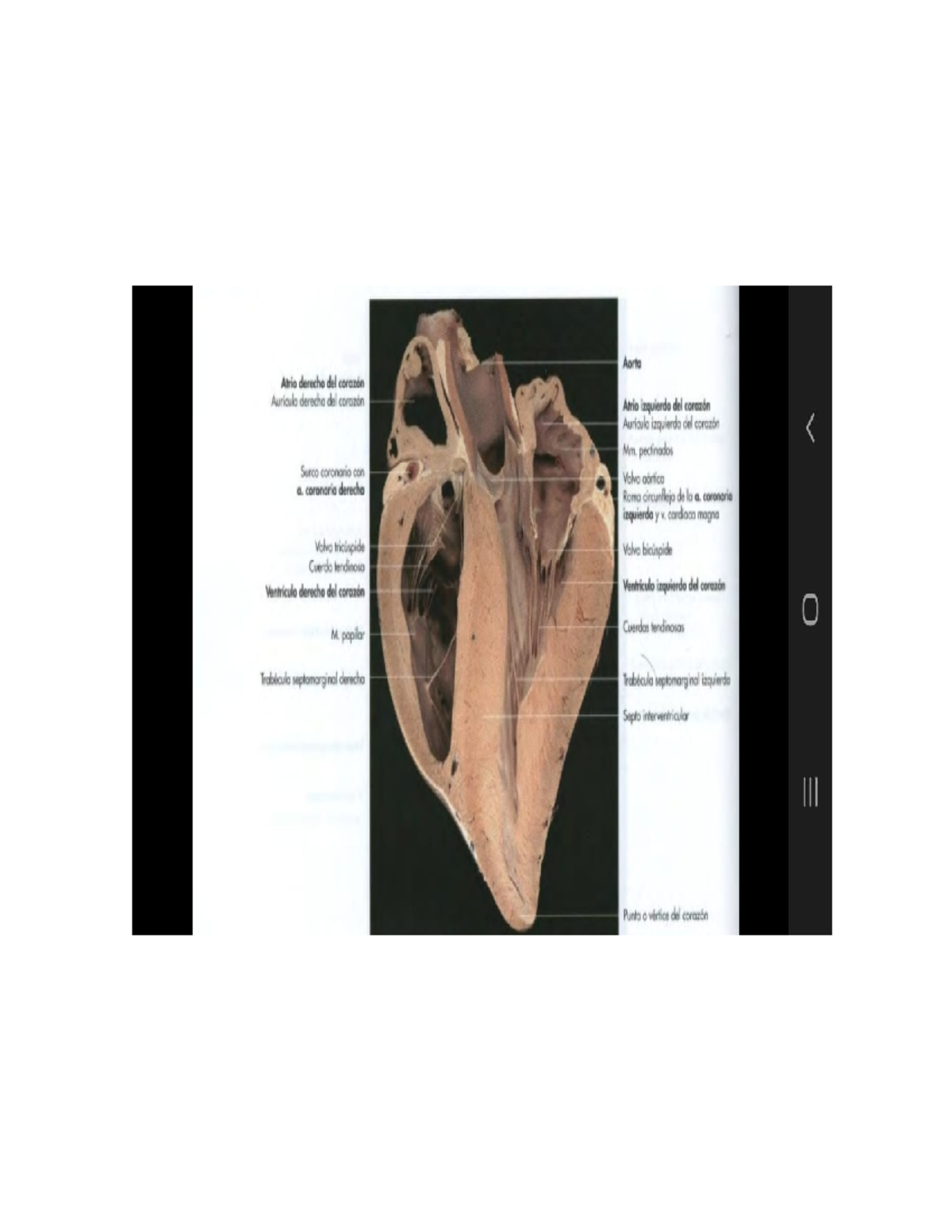 Angio - Articulaciones - Aorta Atrio derecho del corazón Aurícula ...