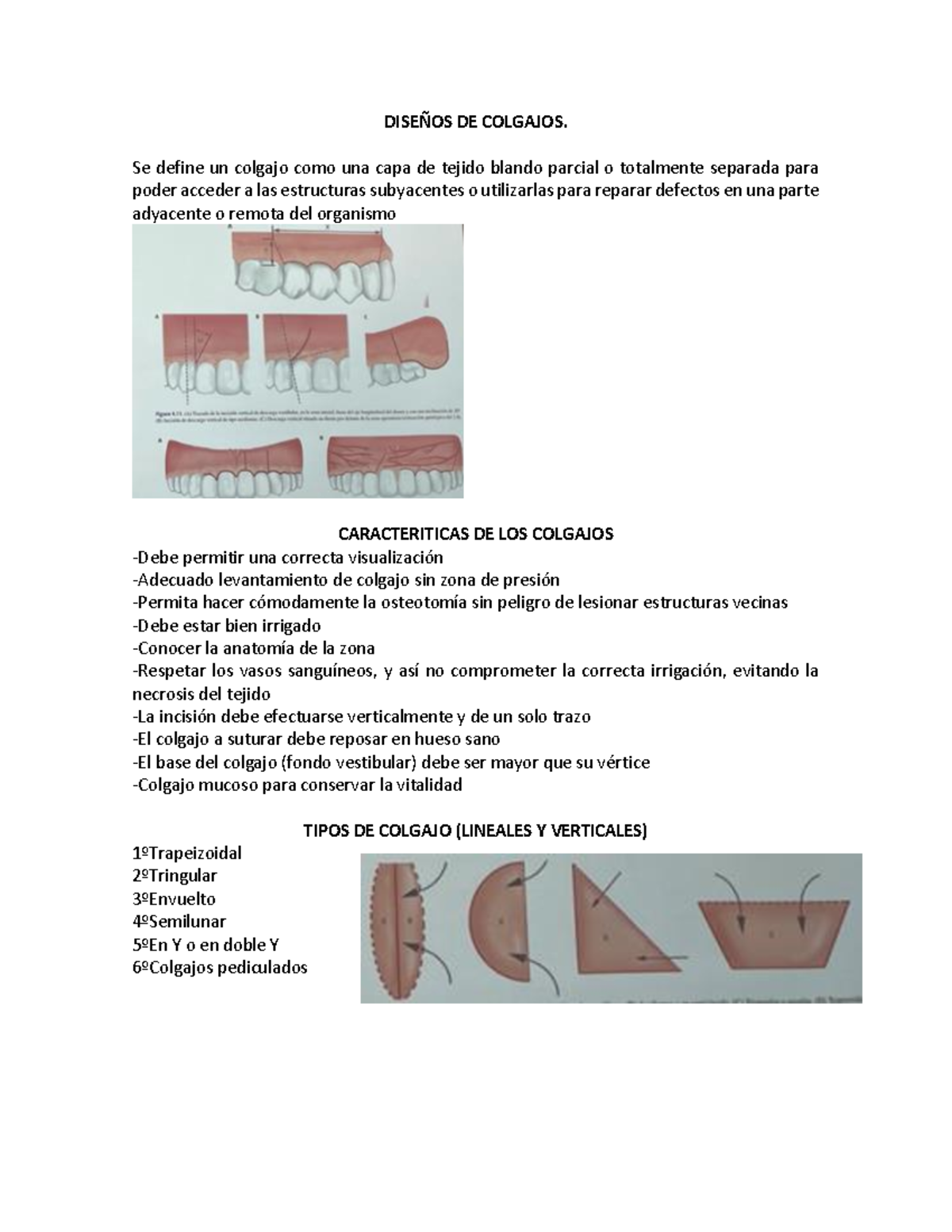 Tipos de colgajo - DISE—OS DE COLGAJOS. Se define un colgajo como una ...
