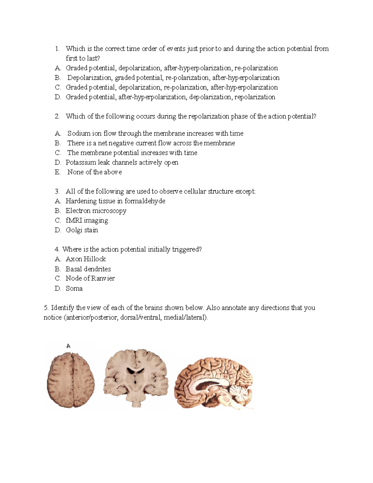 Study questions for exam 2 - Which is the correct time order of events ...