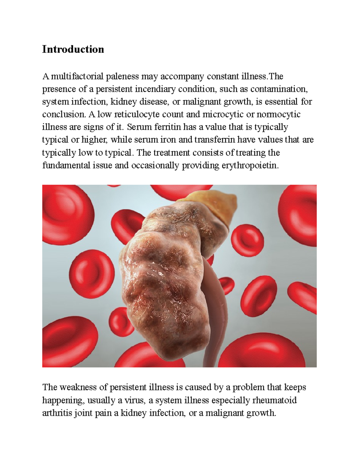 Anemia in Kidney disese - Introduction A multifactorial paleness may ...