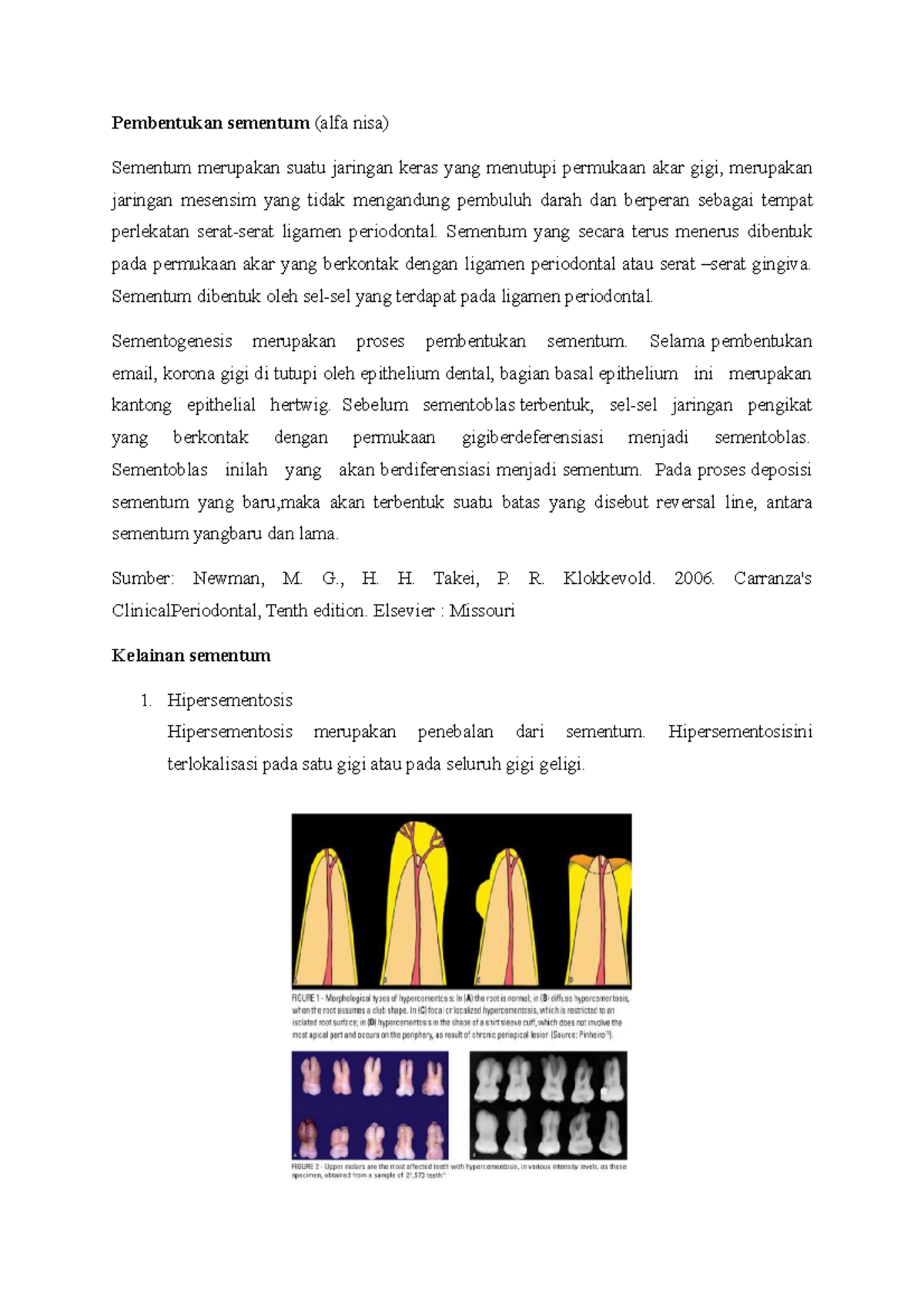 Pembentukan sementum dan kelainan - Pembentukan sementum (alfa nisa ...