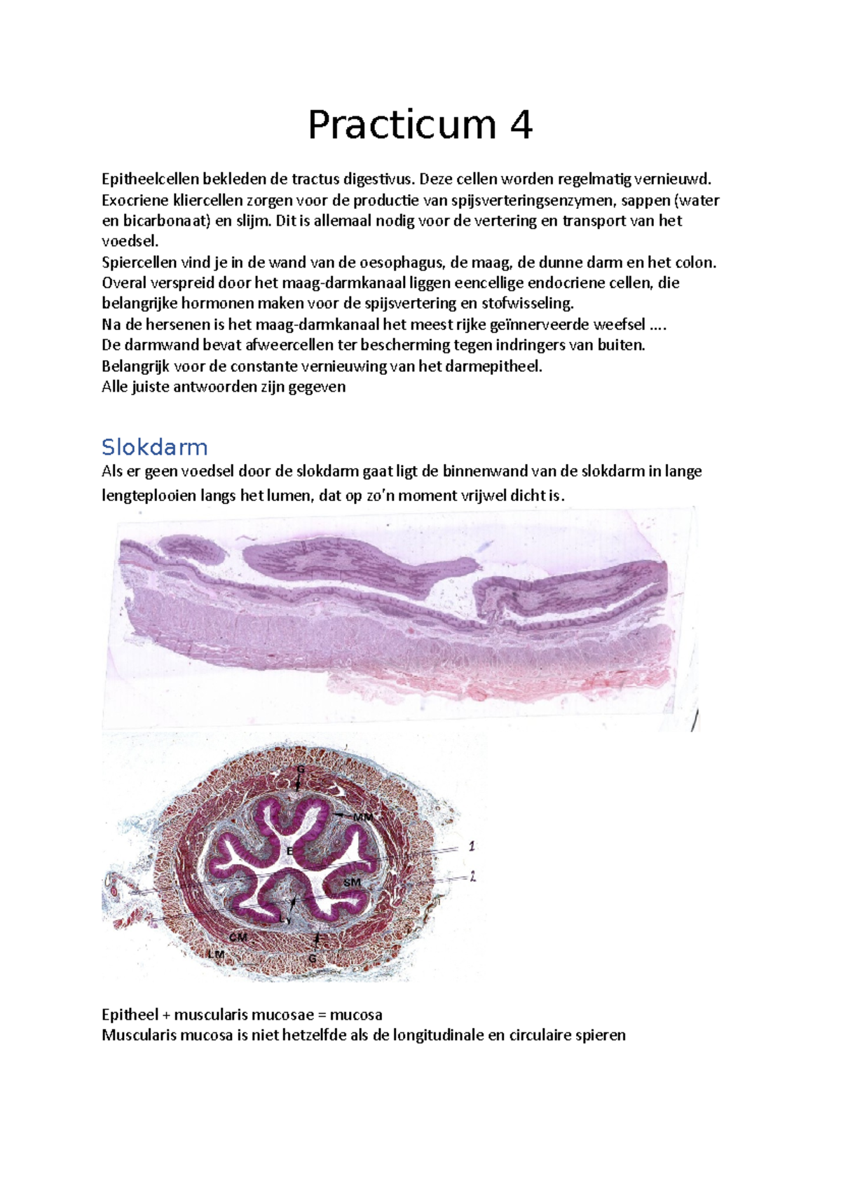 Practicum 4 - Practicum 4 Epitheelcellen bekleden de tractus digestivus ...