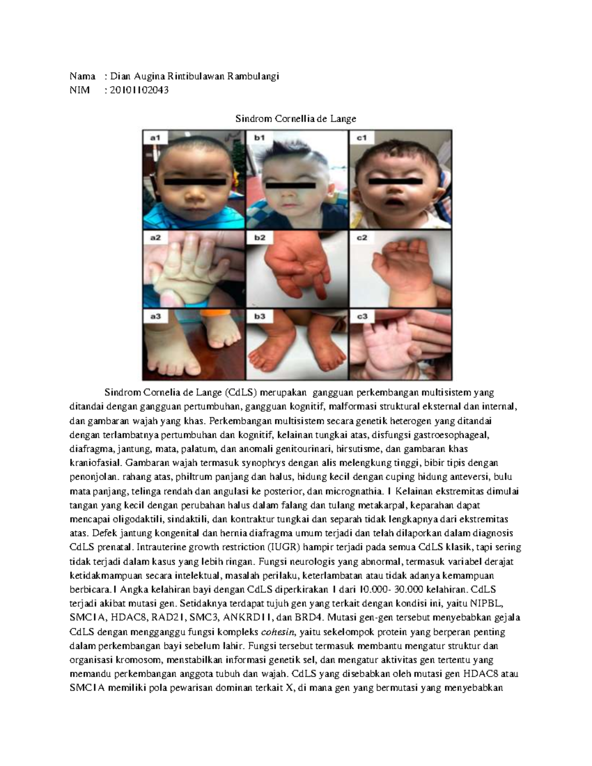Kelainan Kromosom Sindrom Cornelia - Nama : Dian Augina Rintibulawan ...