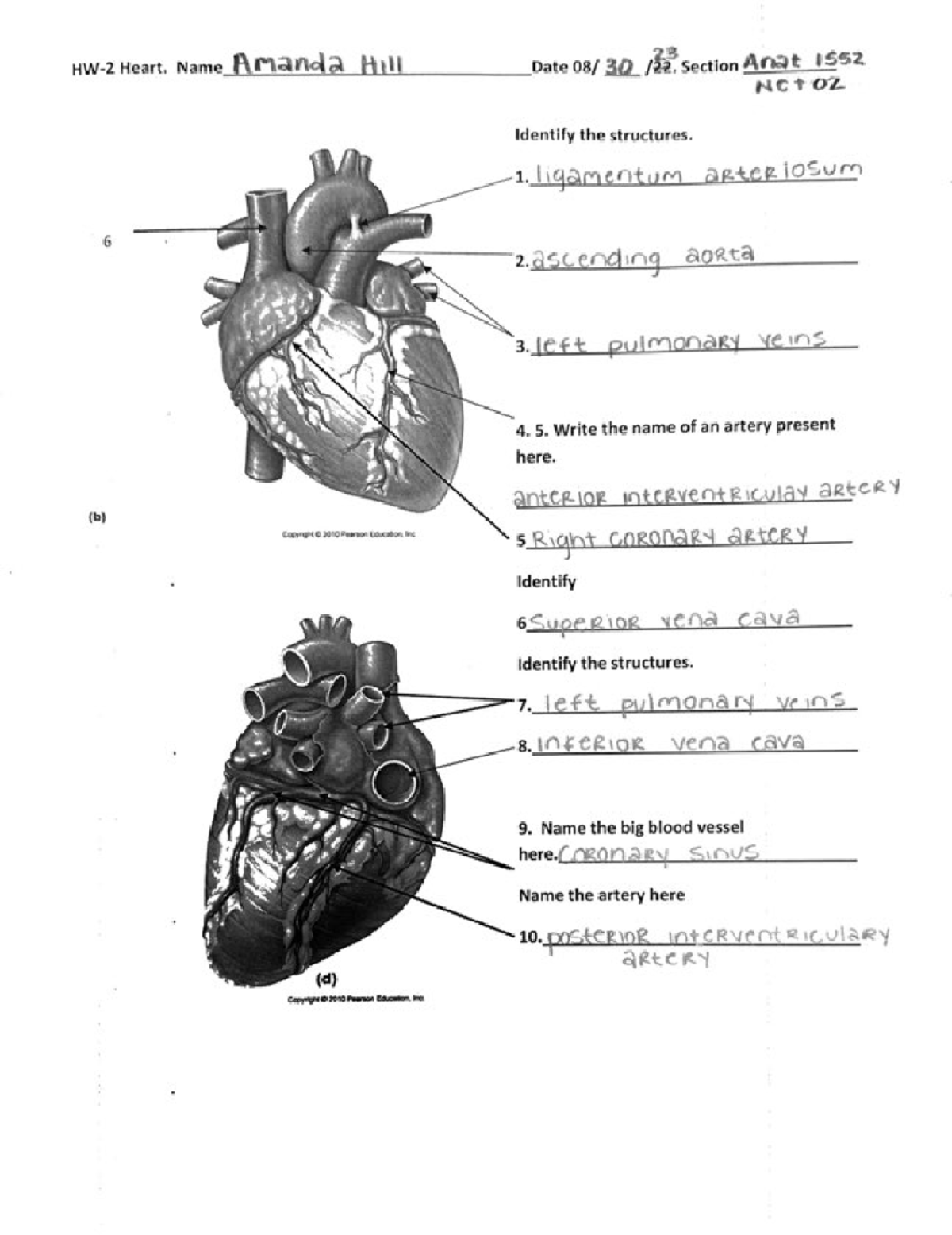 Heart homework - workbook - ANAT 1552 - Studocu