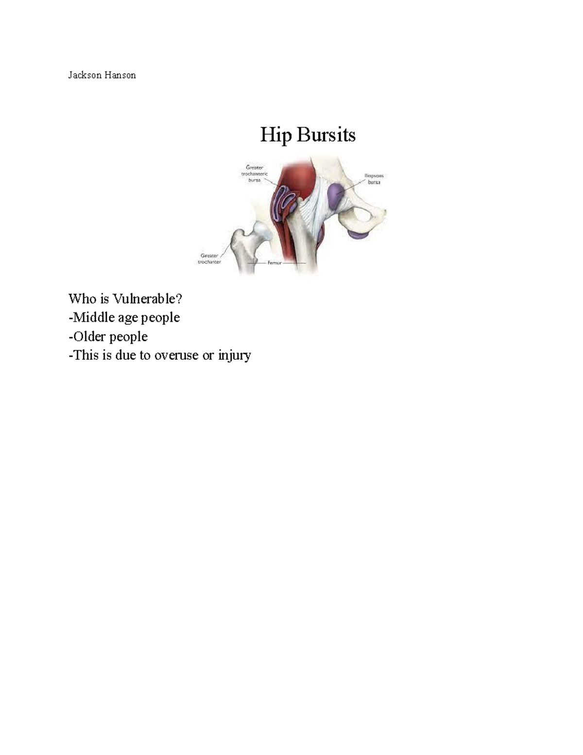 Jackson Hanson - doc - Jackson Hanson Hip Bursits Who is Vulnerable ...