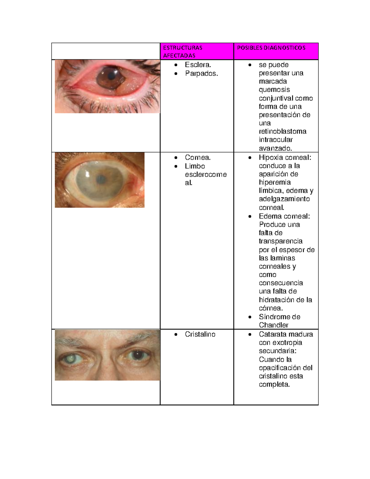 Diagnosticos de ojo - posibles diagnósticos - ESTRUCTURAS AFECTADAS ...