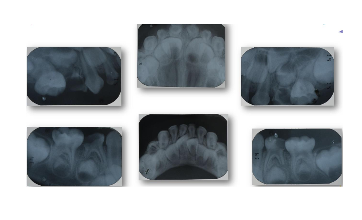 Estudio radiográfico de paciente pediátrico - Interpretación ...