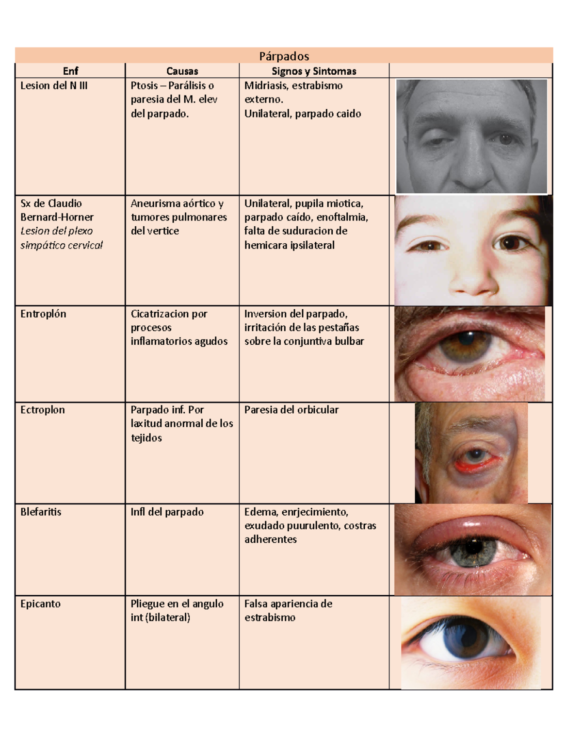 Oculopalpebral - Cuadro comparativo de patologias del ajo y anexos ...