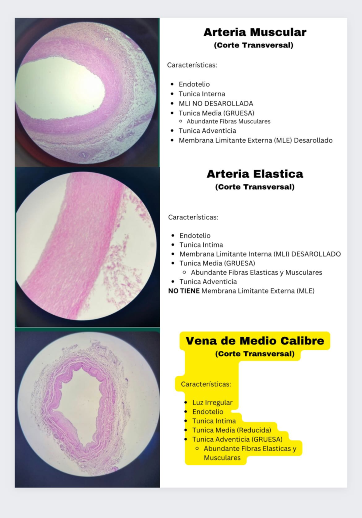 Histo 1st Roté - Arteria Muscular (Corte Transversal) Características ...