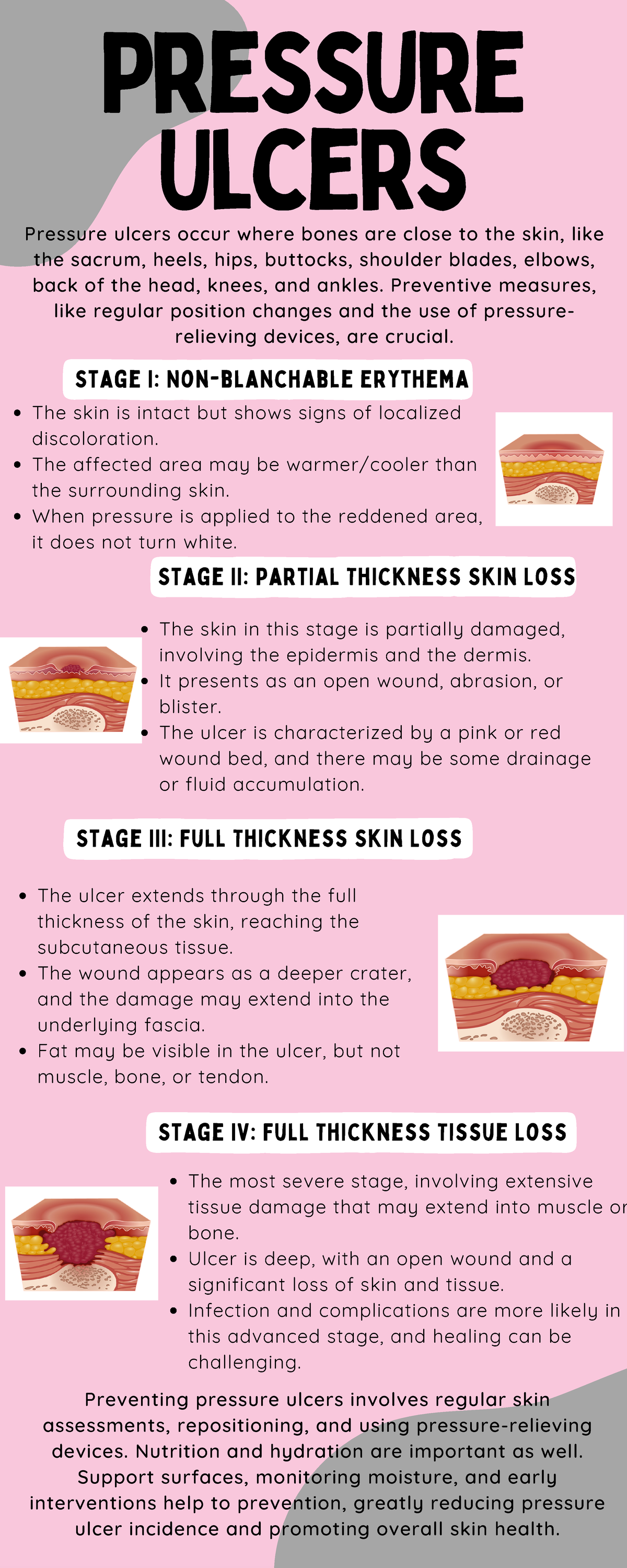 Pressure Ulcers - The skin is intact but shows signs of localized ...