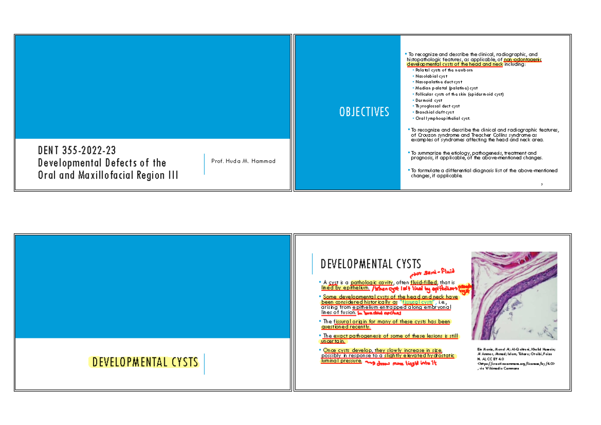 Lec 5-Developmental Defects III-1 .pdf - PDF Expert - DENT 355- 2022 ...