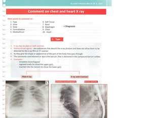 Pelvisanatomymcqs-180608193056 - Pelvis & Perineum Anatomy MCQs with ...