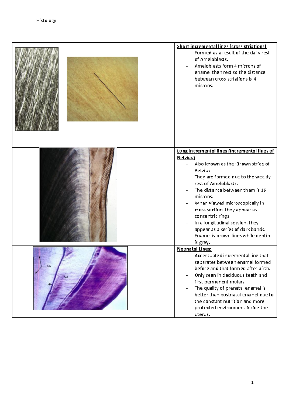 Histology 1019DOH Oral bio notes - Short incremental lines (cross ...