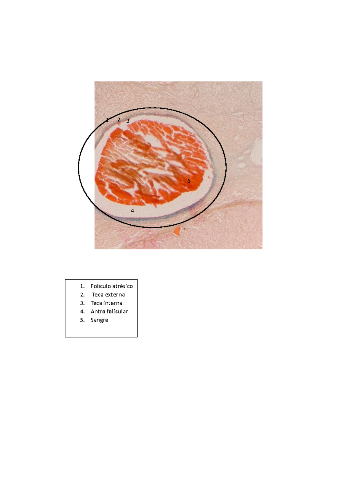 Ovario DE Coneja Virgen Estimulado CON Orina DE Mujer Embarazada ...