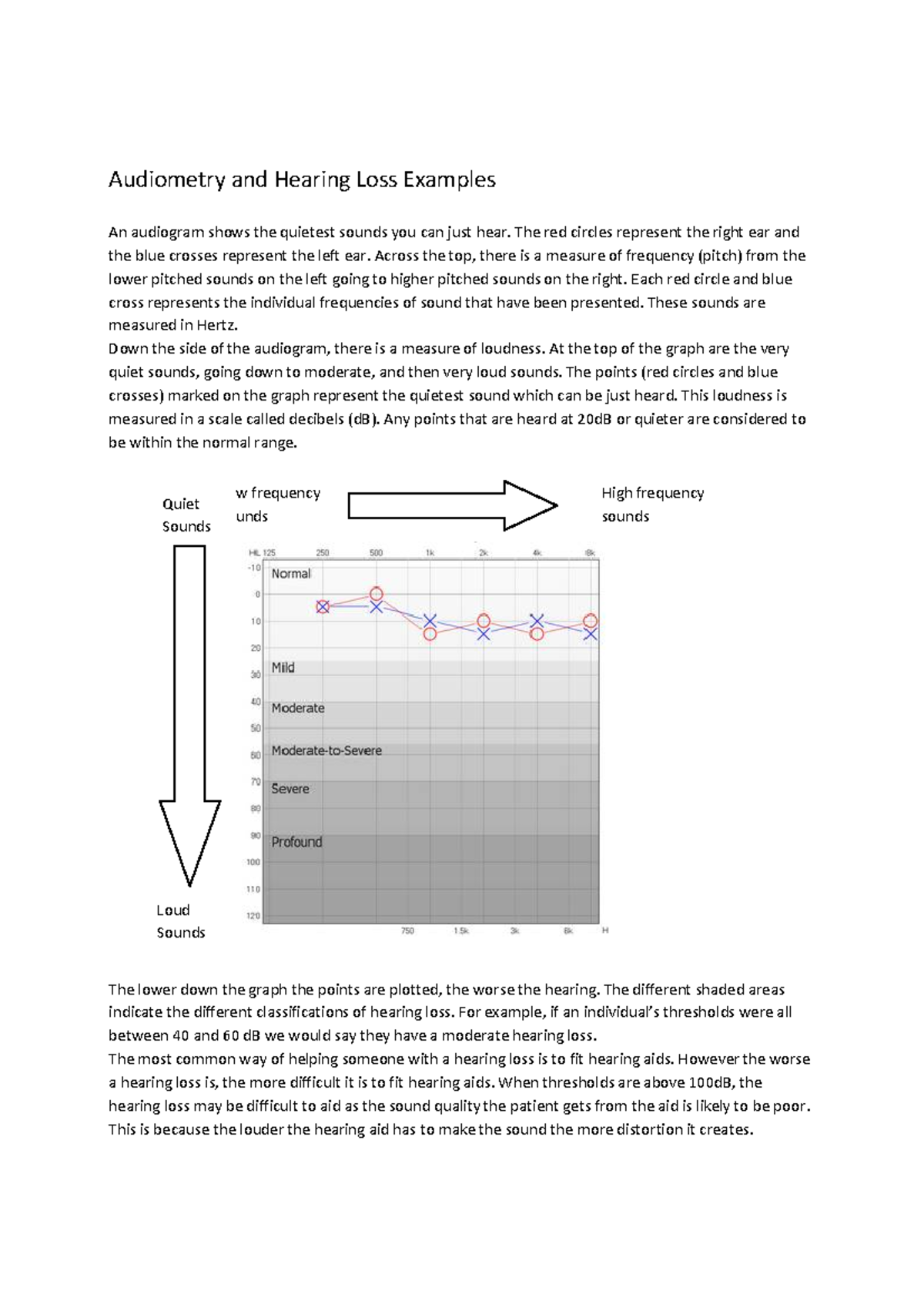 Audiogram Interpretation - Audiometry and Hearing Loss Examples An ...