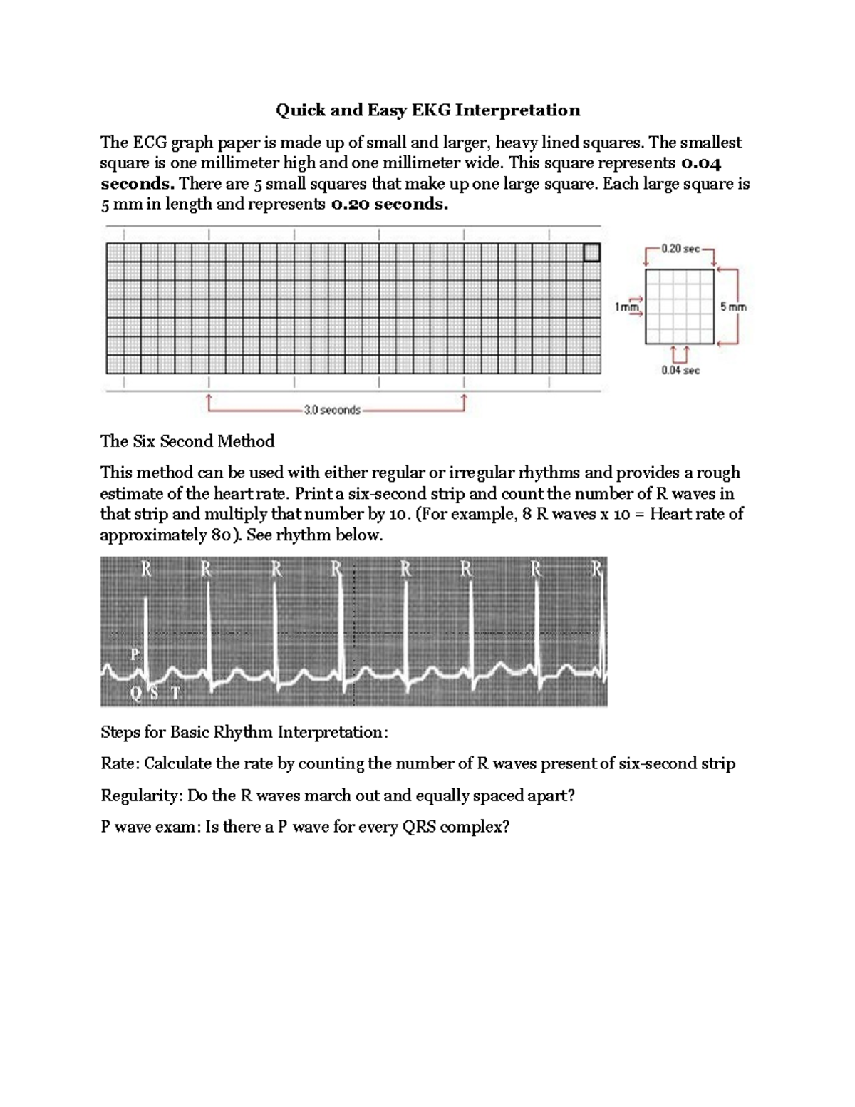 EKG Interpretation - Quick and Easy EKG Interpretation The ECG graph ...