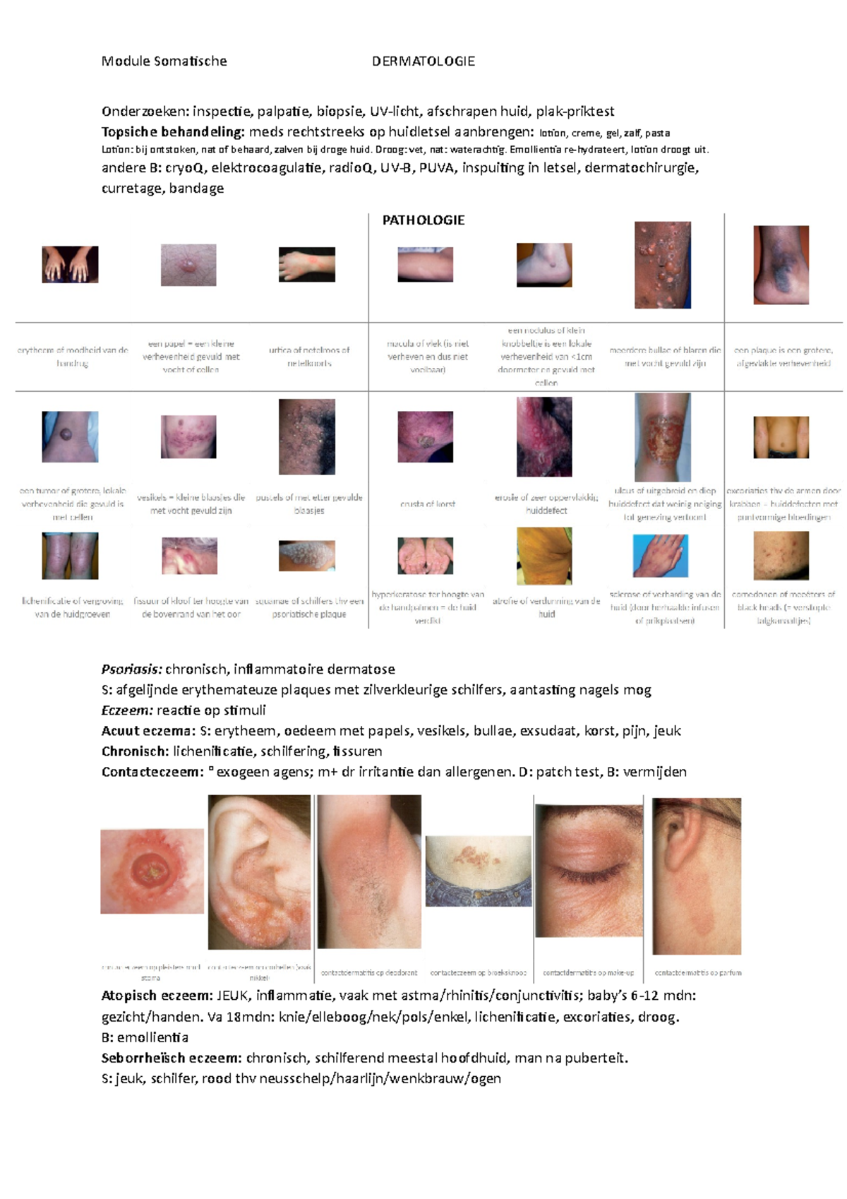 Dermato - Module Somatische DERMATOLOGIE Onderzoeken: inspectie, palpatie, biopsie, UV-licht ...