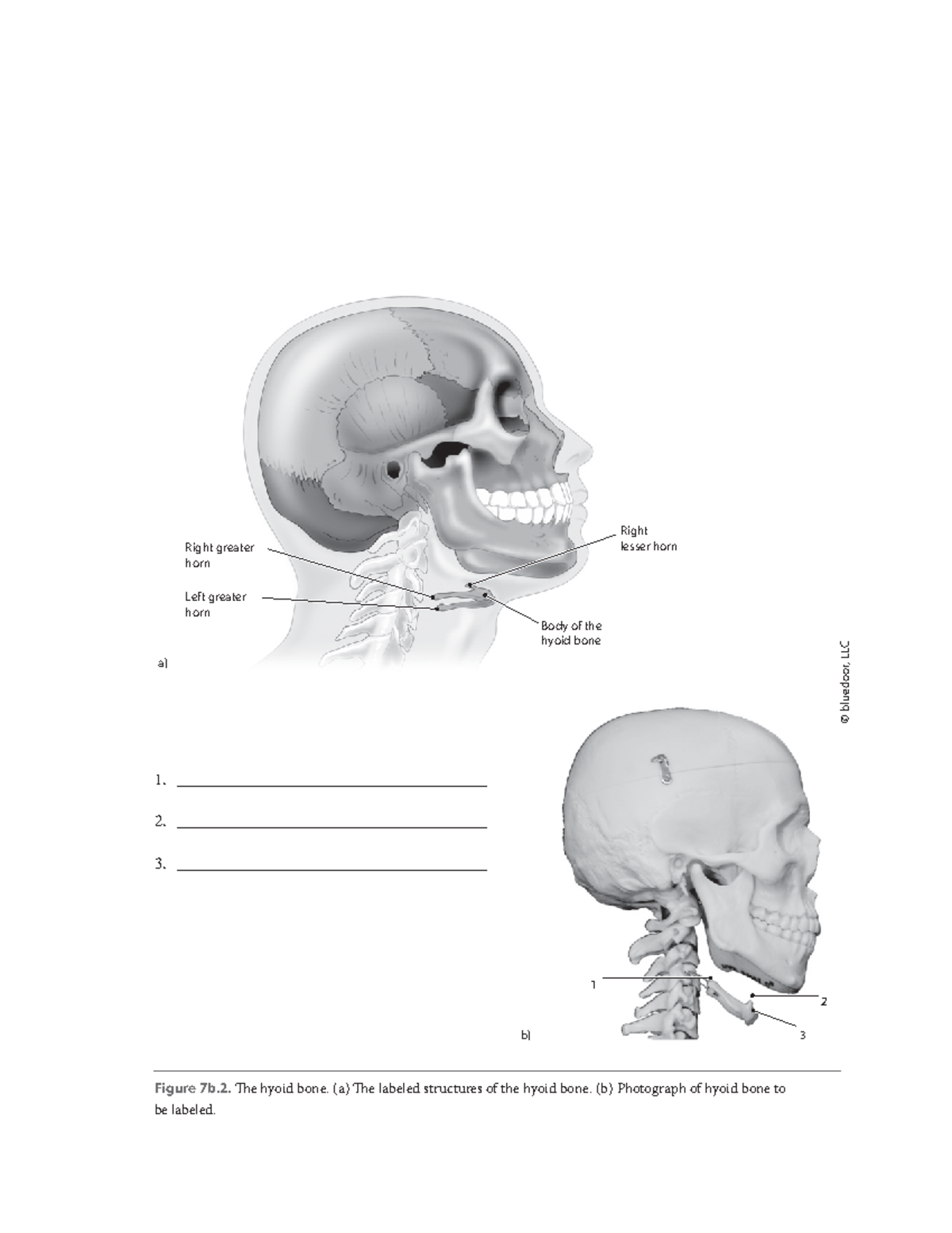 Lab Exercise 7b Axial Skeleton (Hard Copy) - Body of the hyoid bone ...
