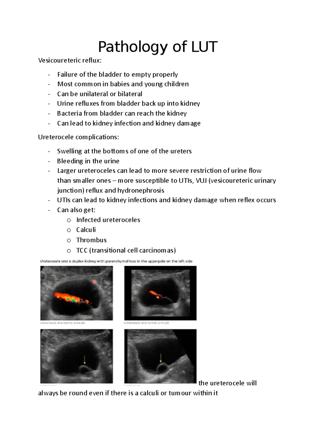 Pathology of LUT - Pathology of LUT Vesicoureteric reflux: Failure of ...