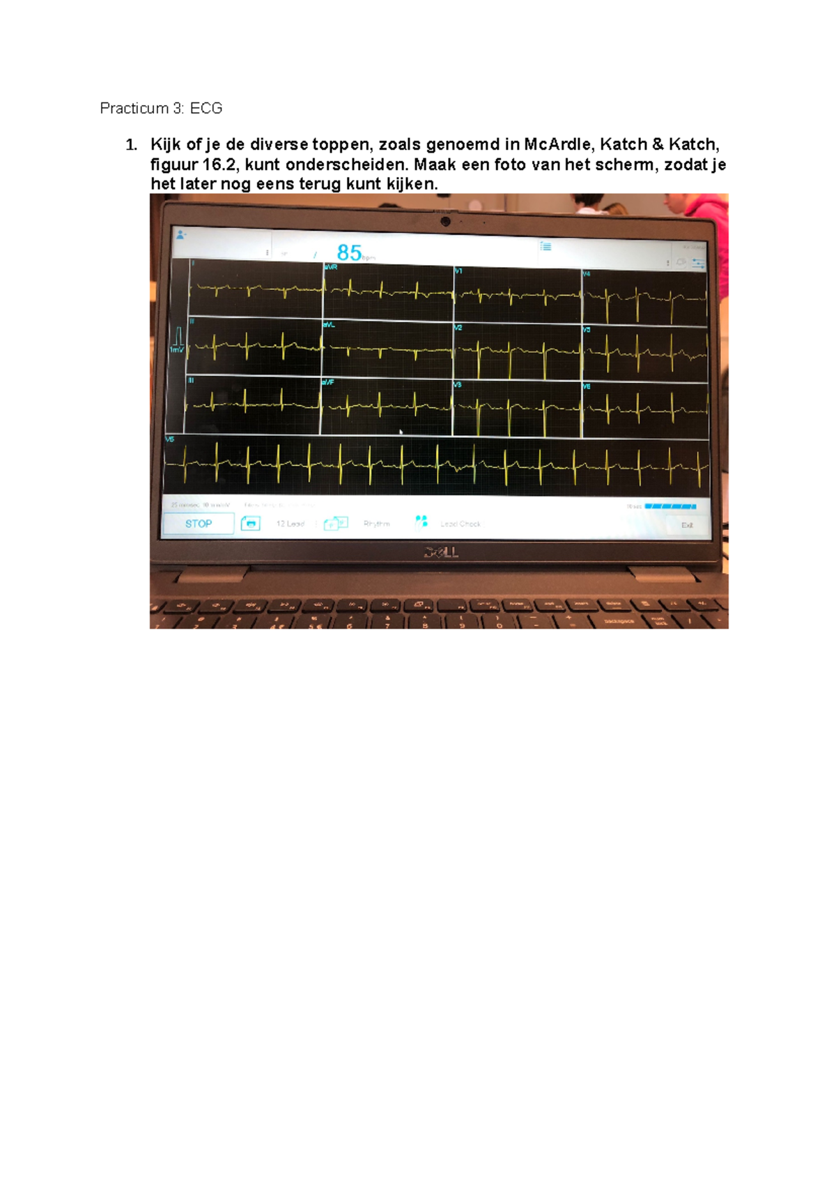 Practicum 3 - Practicum 3: ECG Kijk of je de diverse toppen, zoals genoemd in McArdle, Katch ...