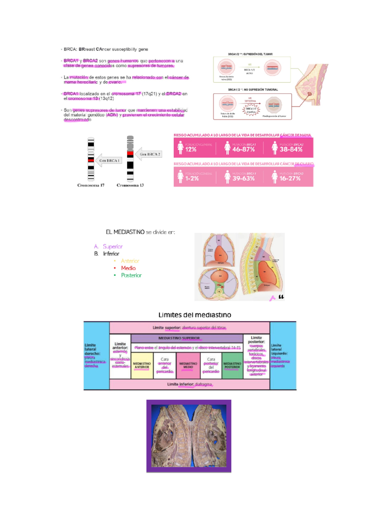 Anatomía apuntes - TIMO Localización, evolución: Es un órgano linfoide ...