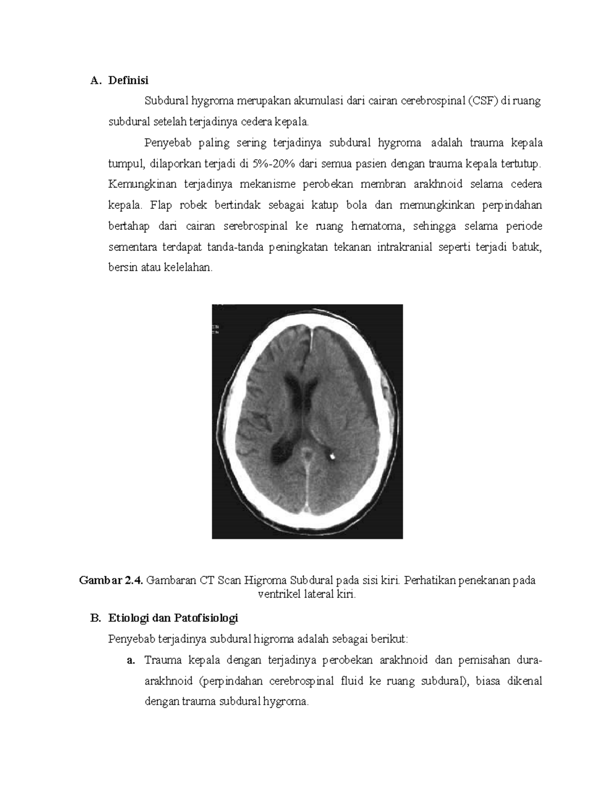 Laporan pendahuluan subdural higroma - A. Definisi Subdural hygroma ...