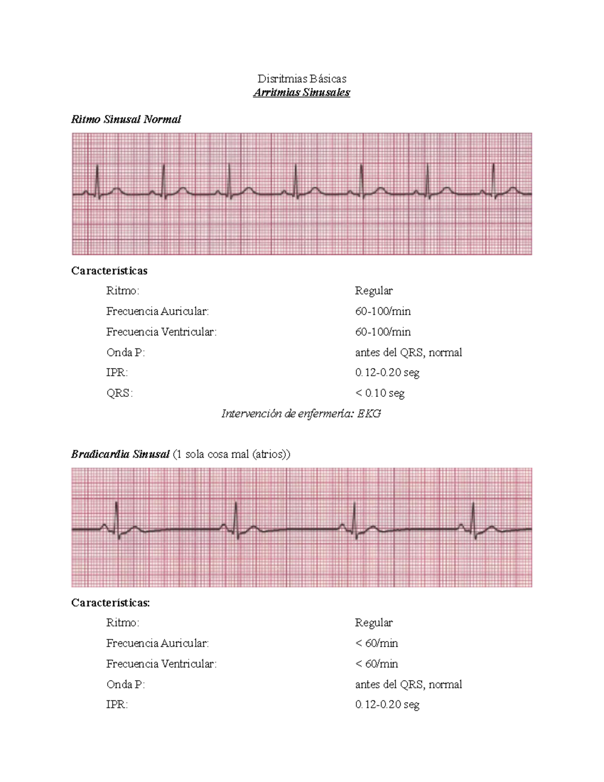 Disritmias Básicas - Tema de repaso examen EKG - Disritmias Básicas ...