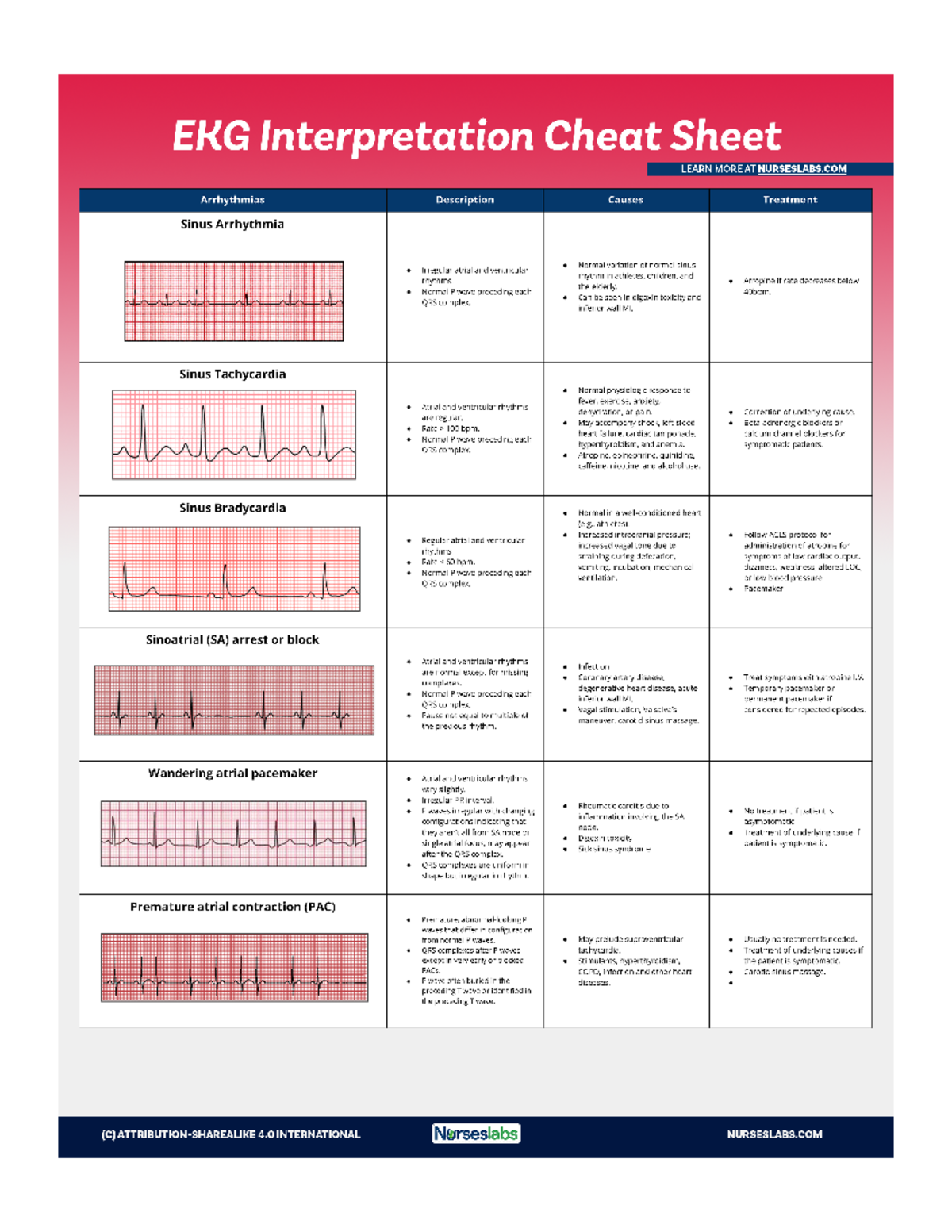 ECG Cheat Sheet - ECG MADE EASY - maternal and child in nursing - Studocu