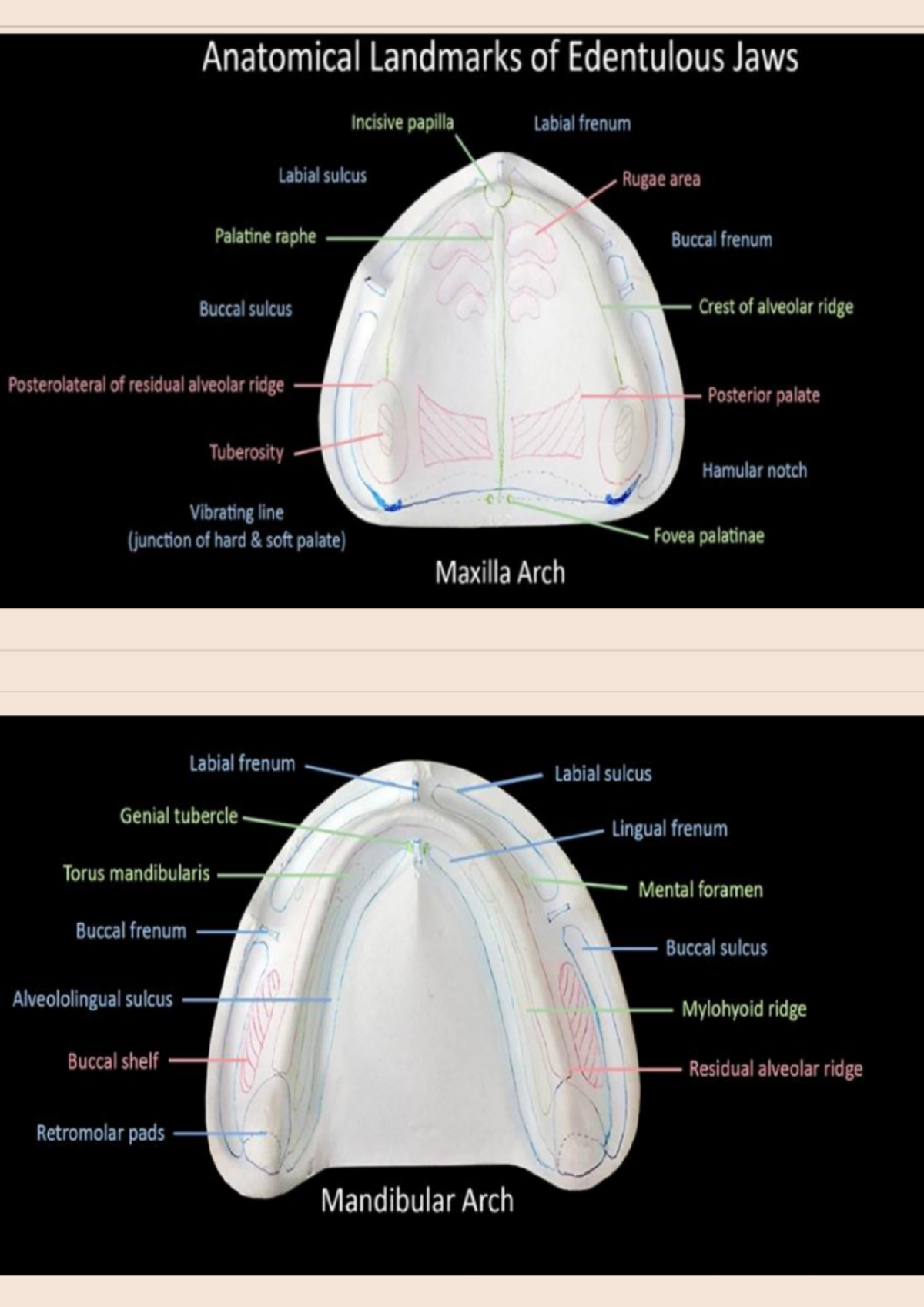 Anatomical landmarkspdf - Anatomical Landmarks of Edentulous Jaws ...