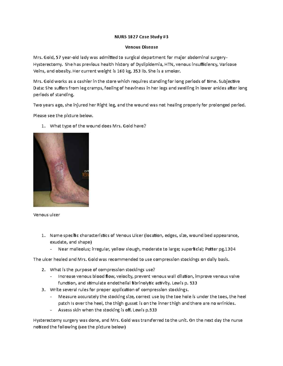 DVT Case Study with answers - NURS 1027 Case Study # Venous Disease Mrs ...