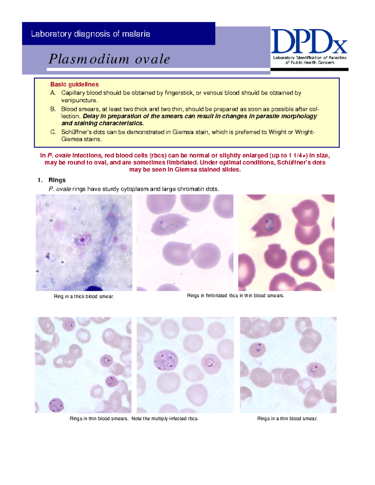 P. ovale - atlas - Plasmodium ovale Basic guidelines A. Capillary blood ...