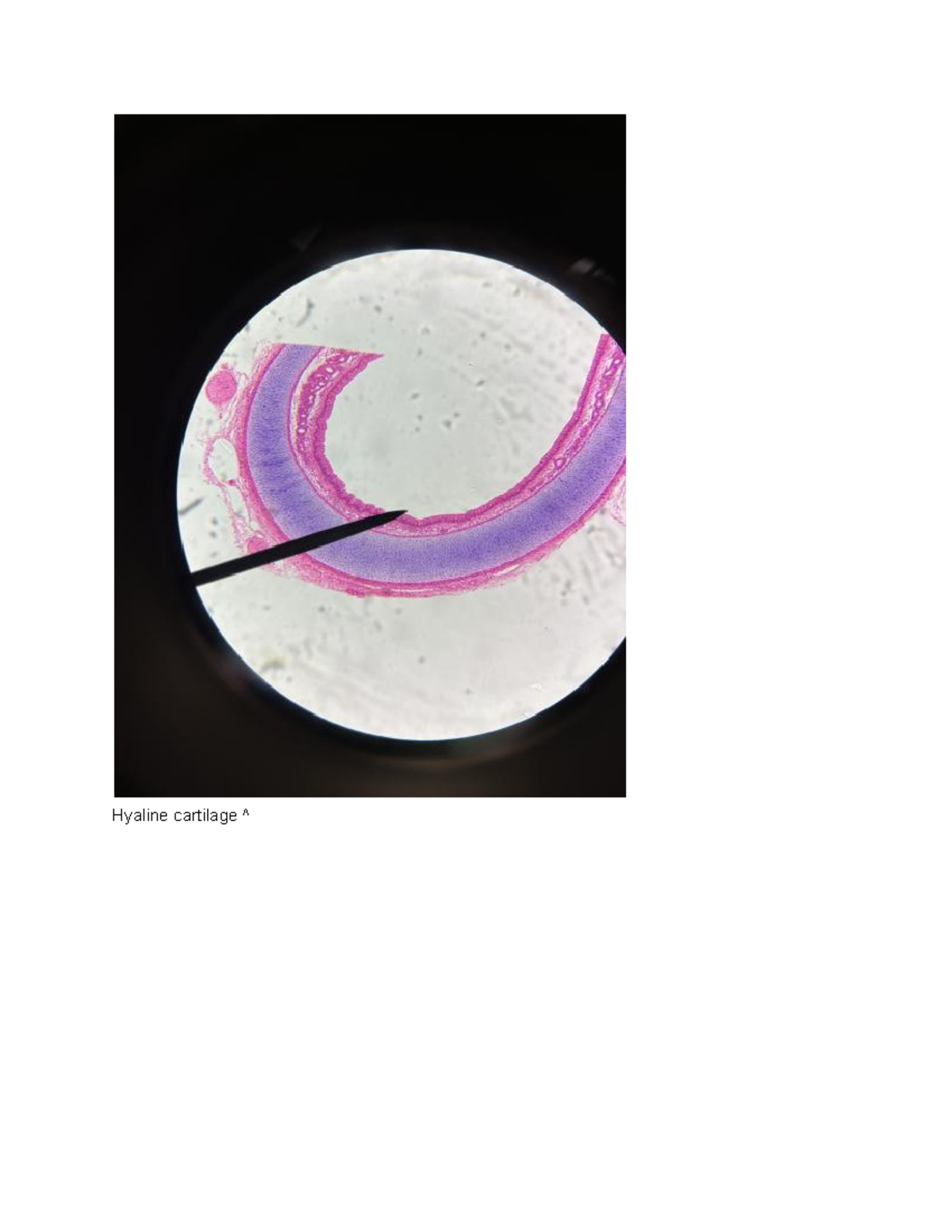 Examples of slides used in class bio11 - Hyaline cartilage ^ Adipose CT ...