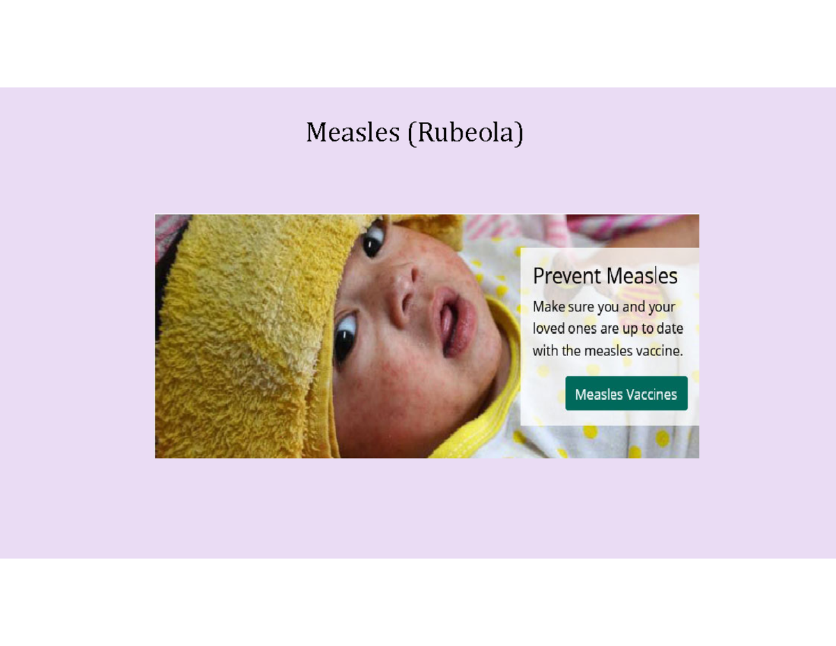 Measles - • Very contagious • Humans are the only natural hosts of ...