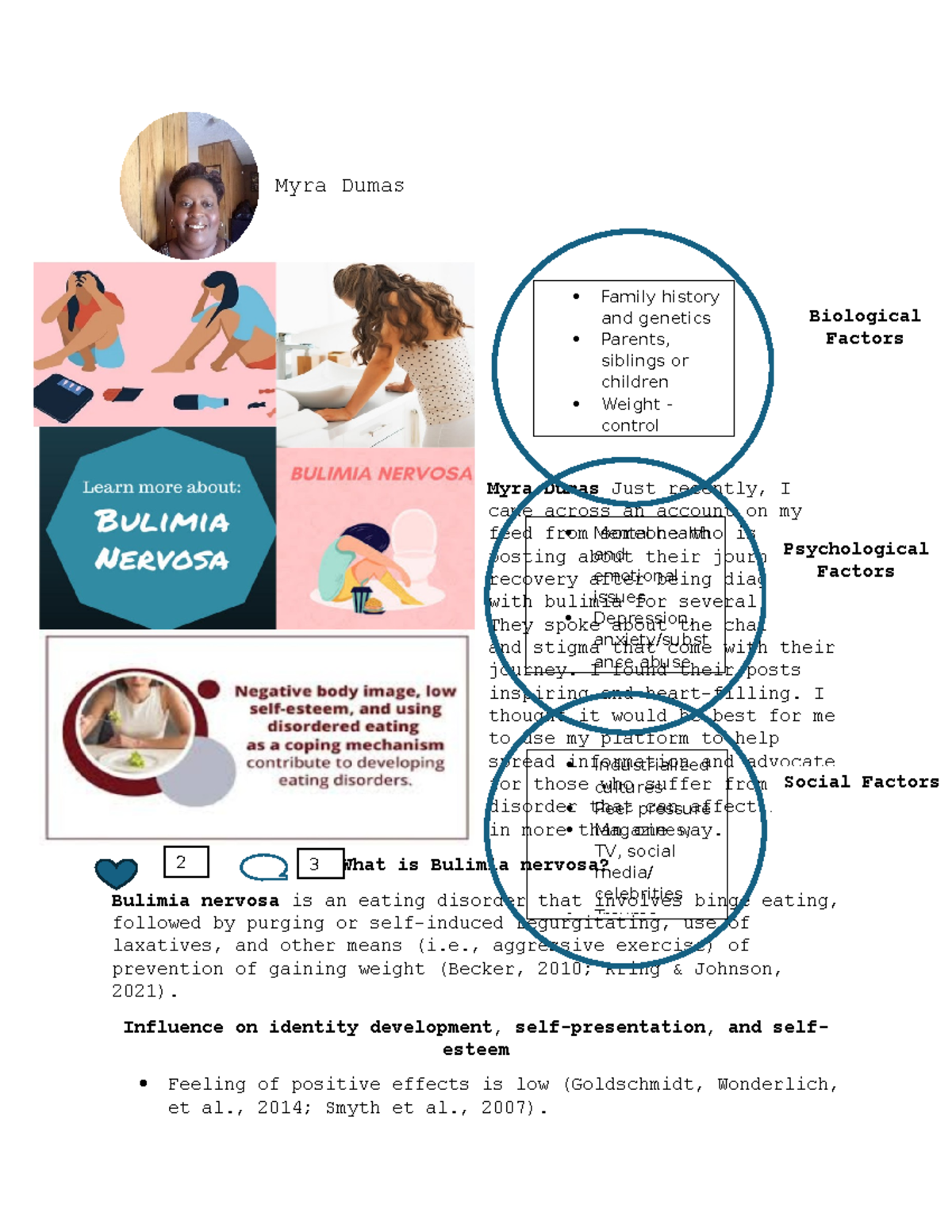 Eating Disorder Risks and Treatment Options MDumas 10132024 - Myra ...
