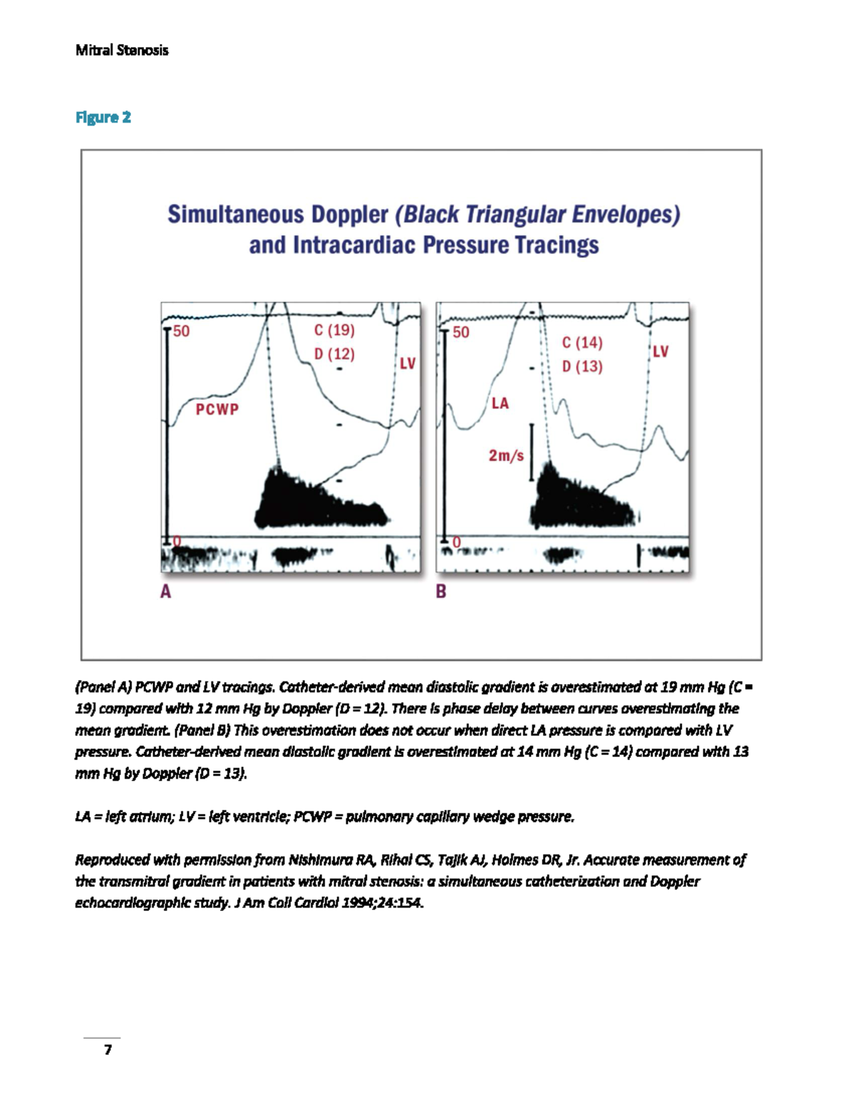 Hemodynamics of mitral stenosis - VALV112 - Studocu