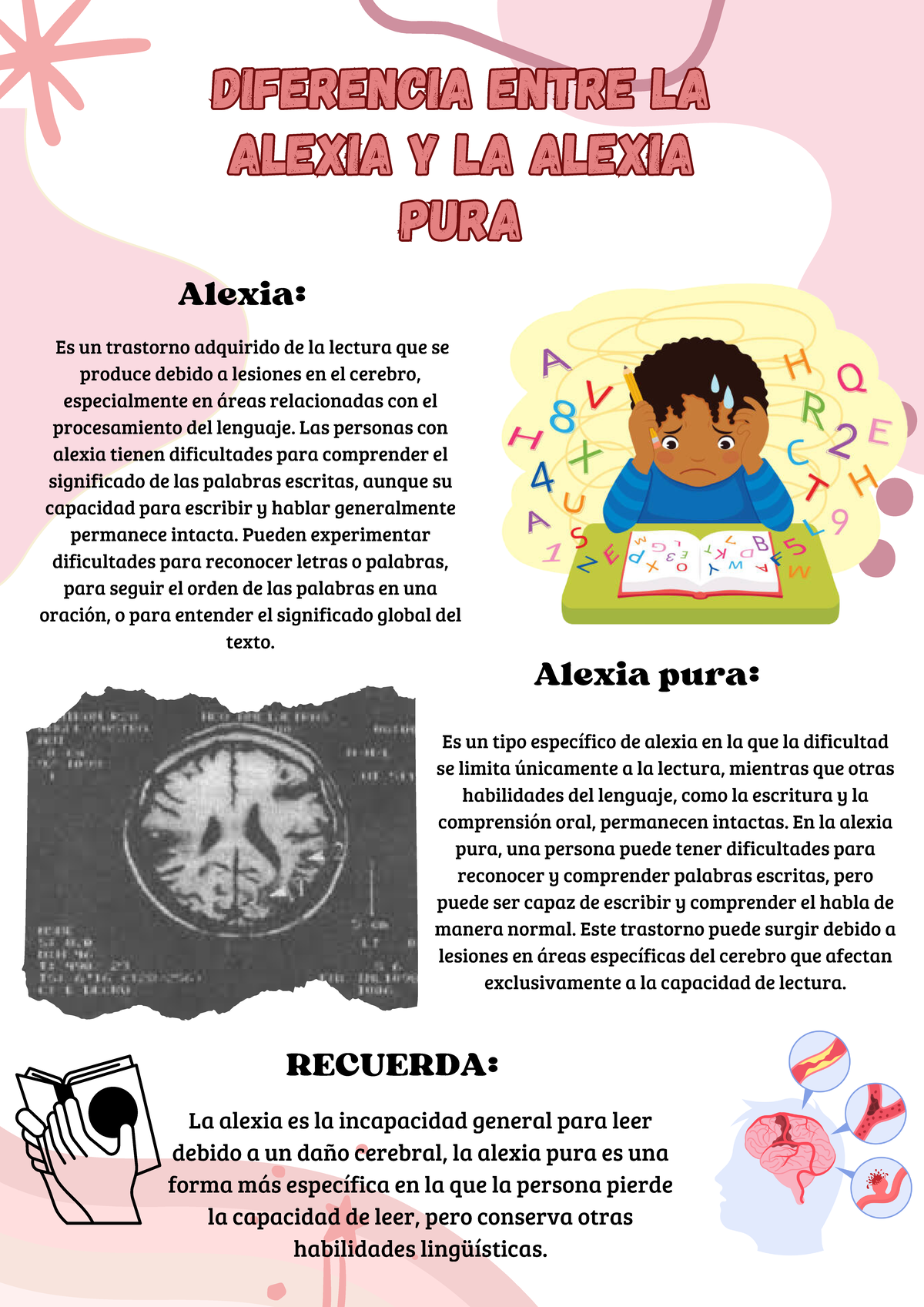 Alexia - Diferencia entre la alexia y la alexia pura Diferencia entre ...