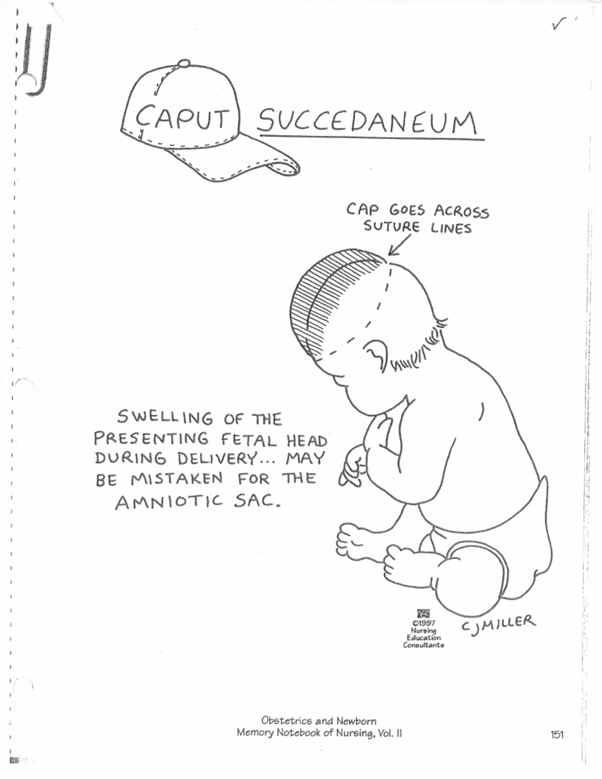 Newborn nursing mnemonics - NURS 4284 - Studocu