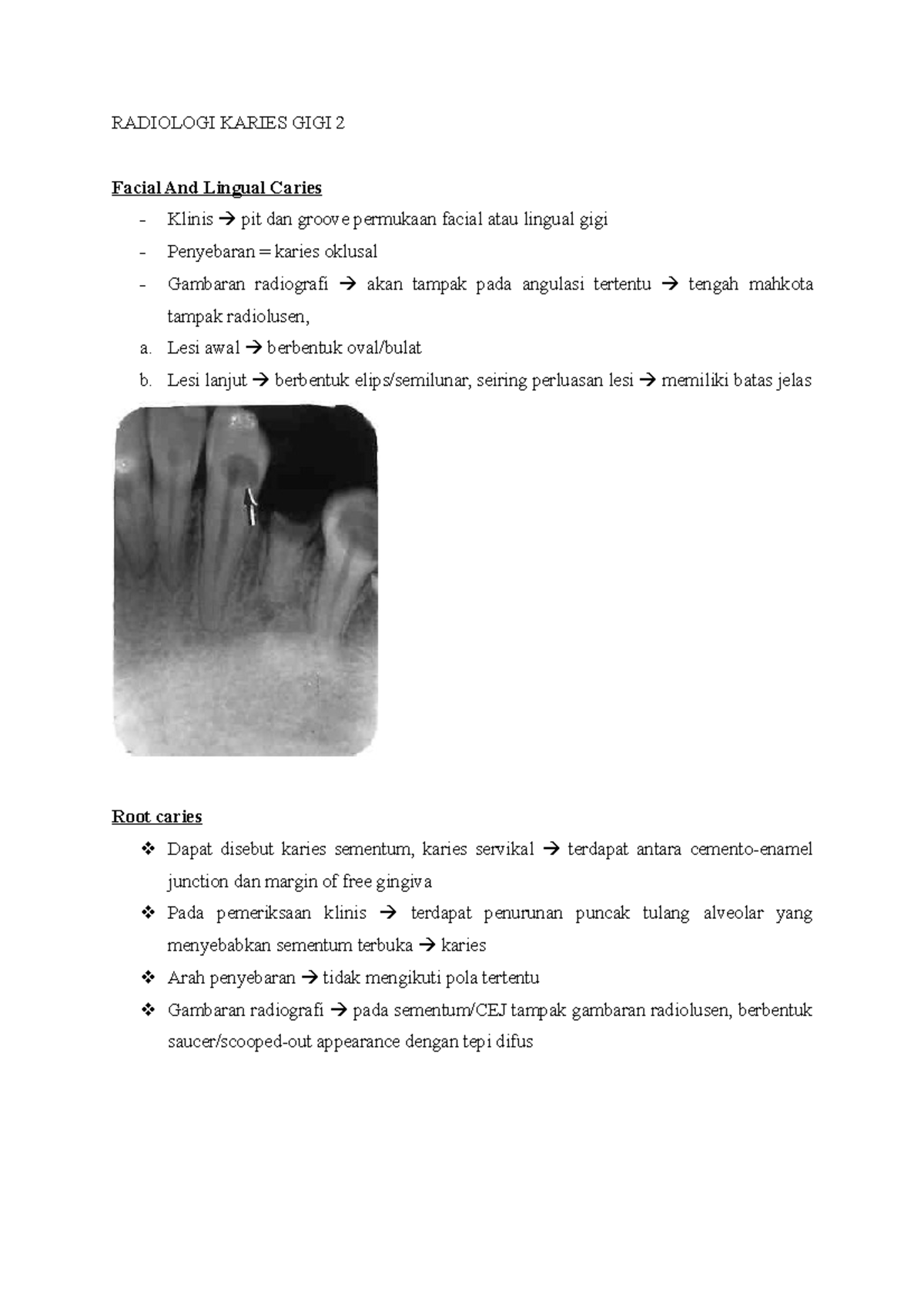 Radiologi Karies Gigi 2 - RADIOLOGI KARIES GIGI 2 Facial And Lingual ...