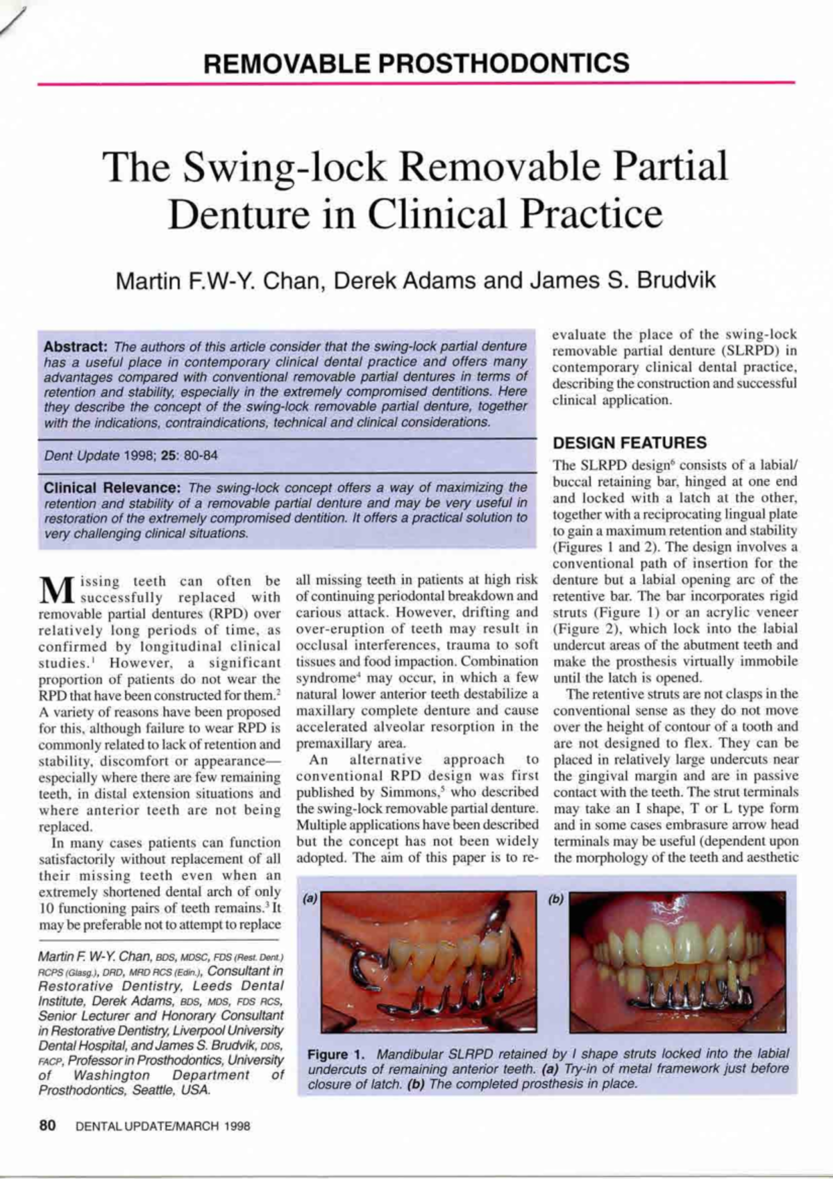 Pub-11 - Swing lock removable partial dentures in clinical practice ...