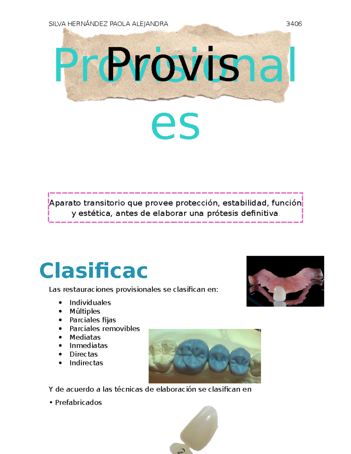 Elaboración de provisionales - . Provisional es Aparato transitorio que ...