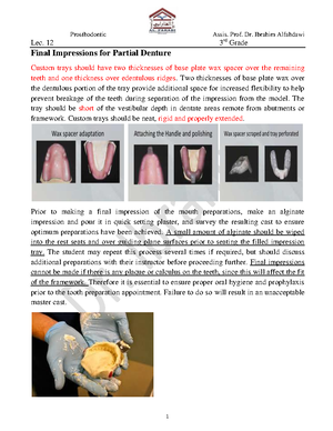 Prosthodontics Lec (7) - Lec. 7 3 rd Grade MAXILLARY MAJOR CONNECTORS ...