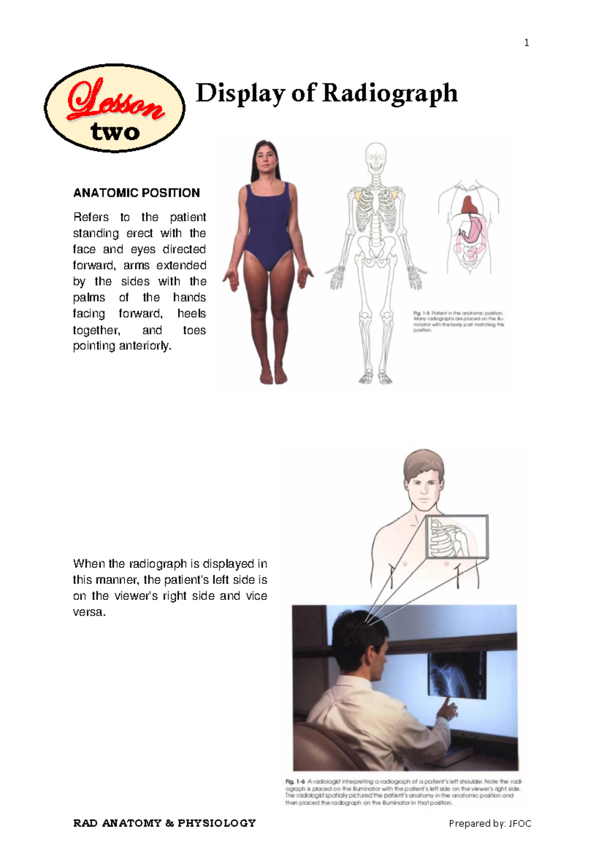 Rad Ana 2 - Rad Anatomy and Physiology - ANATOMIC POSITION Refers to ...