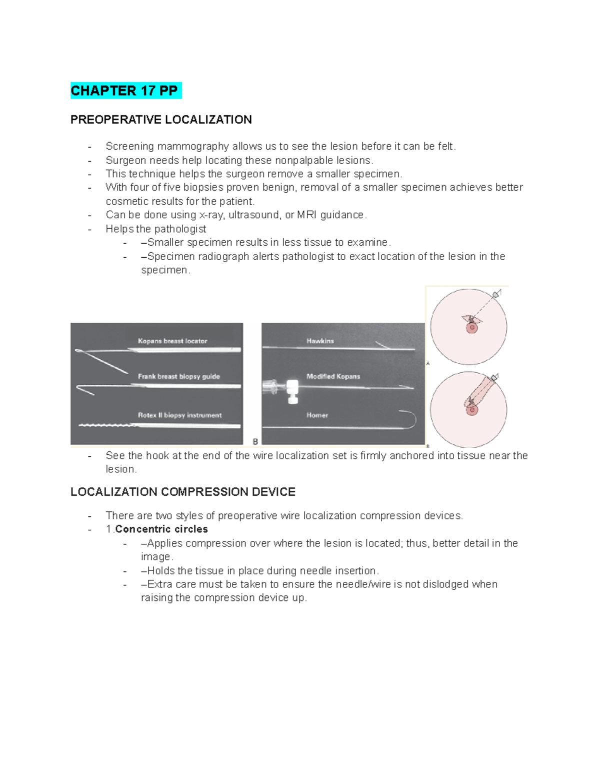 Mammo EXAM 4 - xxxxxxxxx - CHAPTER 17 PP PREOPERATIVE LOCALIZATION ...