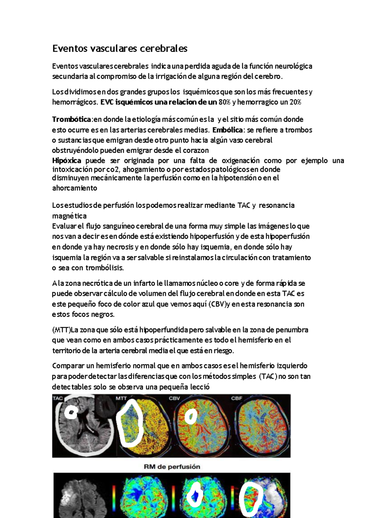 EVC exposicion - Evc - Eventos vasculares cerebrales Eventos vasculares cerebrales indica una ...